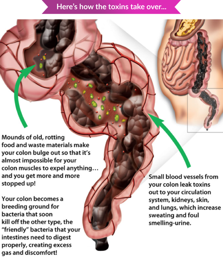 Constipation & Bowel Movement - Functional Health Network Functional ...